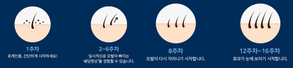 로게인폼 가격 효과 사용법 알아보기바르는 탈모약 부작용은 없나 헬스플러스
